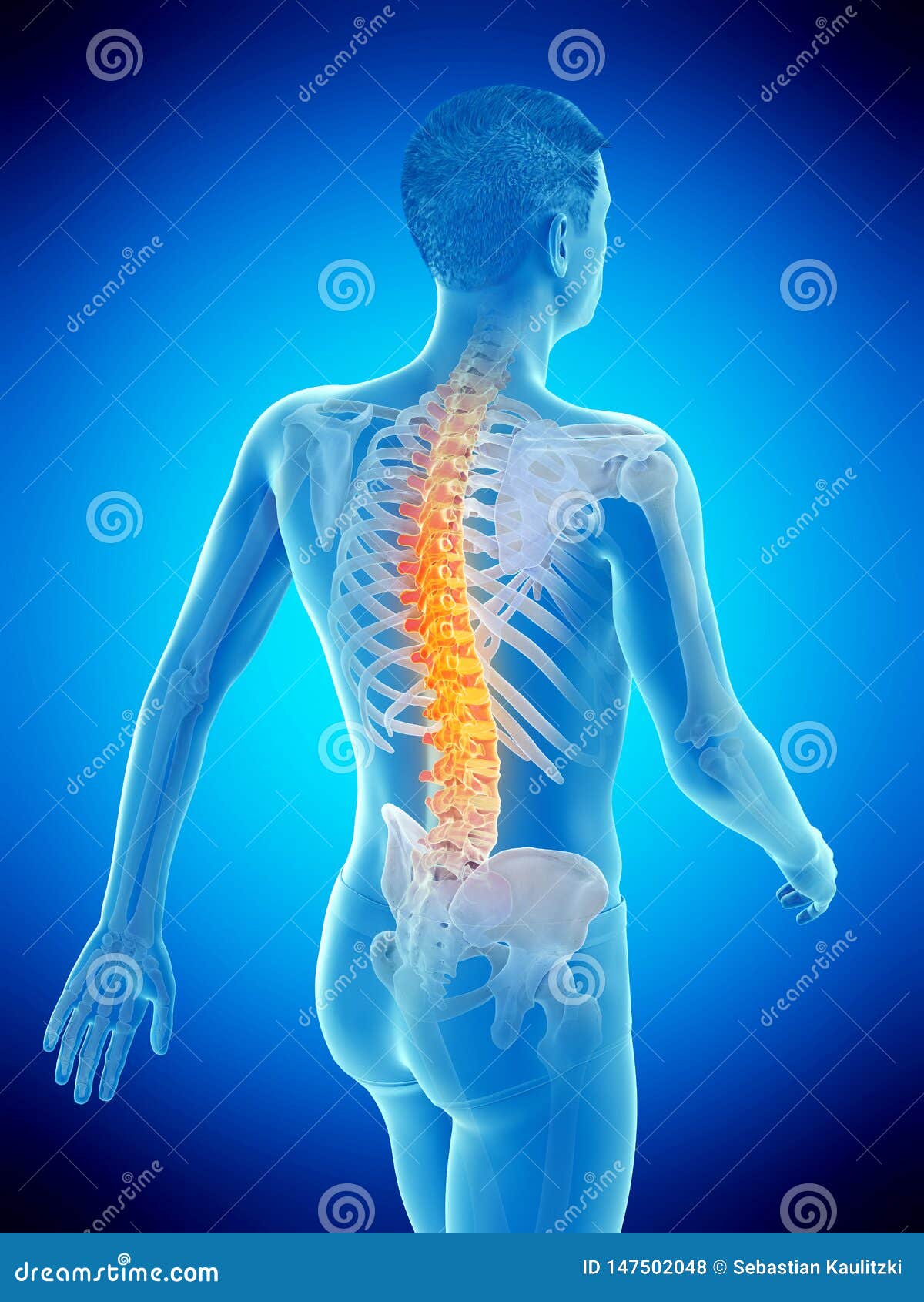 A painful back stock illustration. Illustration of painful - 147502048