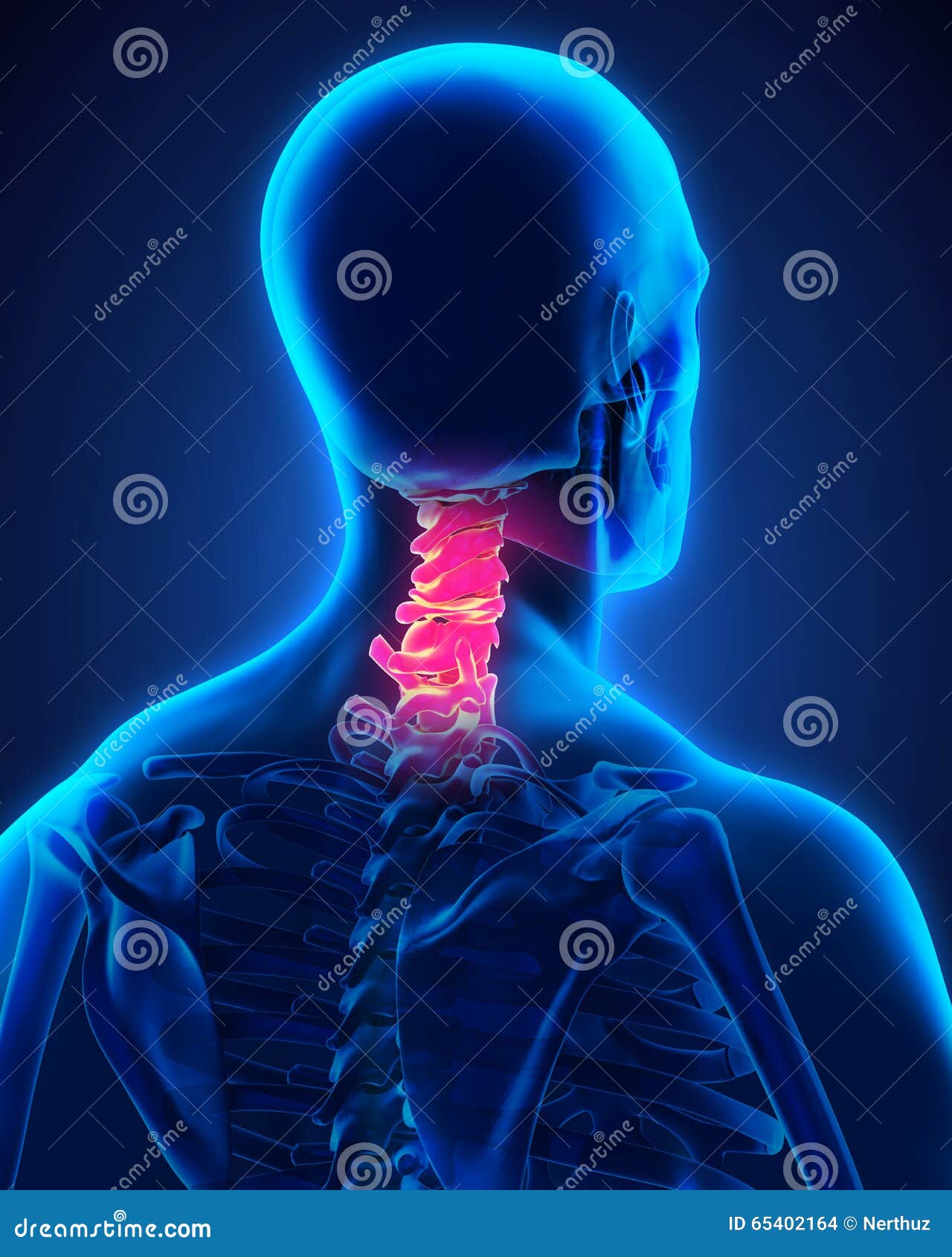 A Painful Thoracic Spine Royalty-Free Cartoon | CartoonDealer.com ...