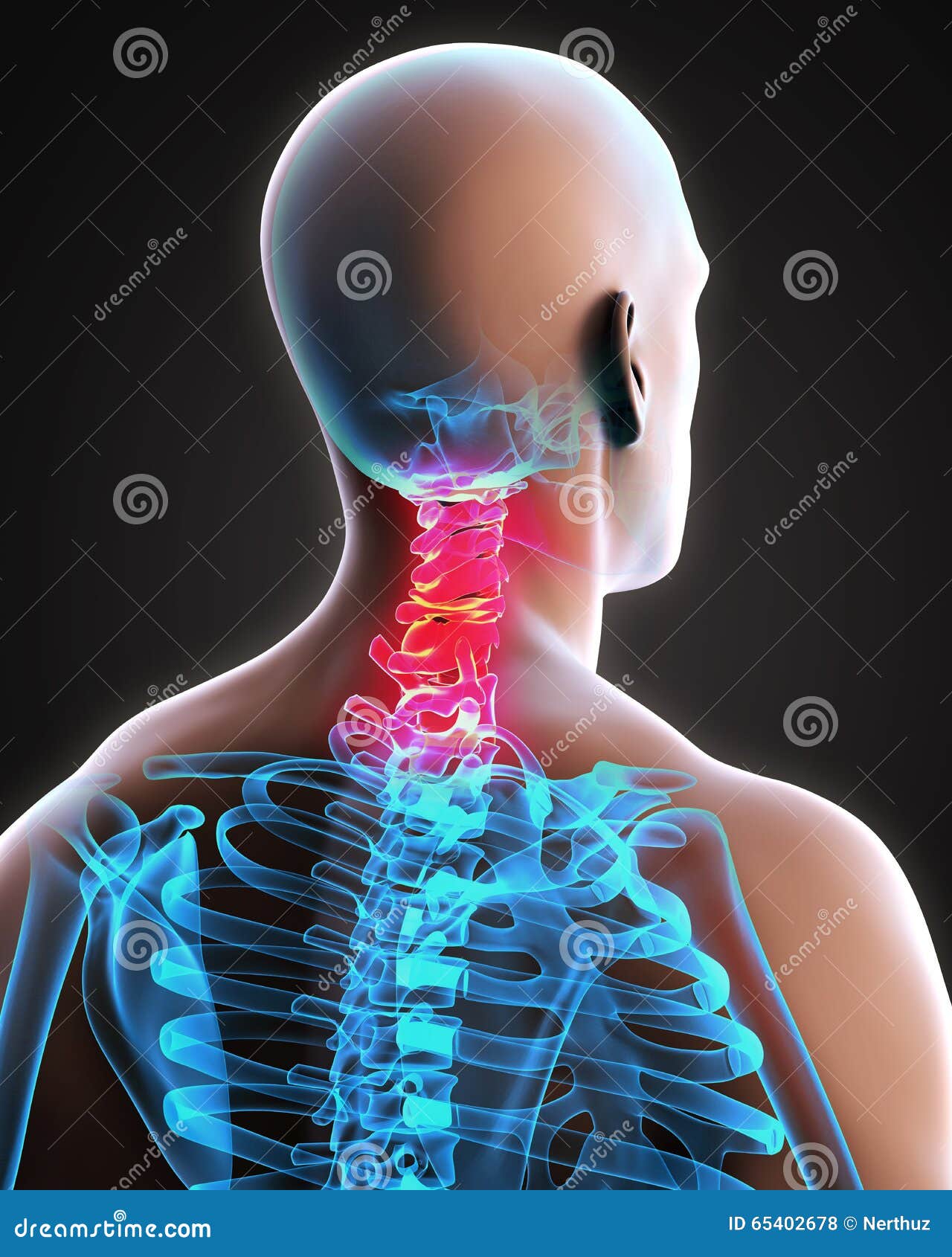 A Painful Thoracic Spine Royalty-Free Cartoon | CartoonDealer.com ...