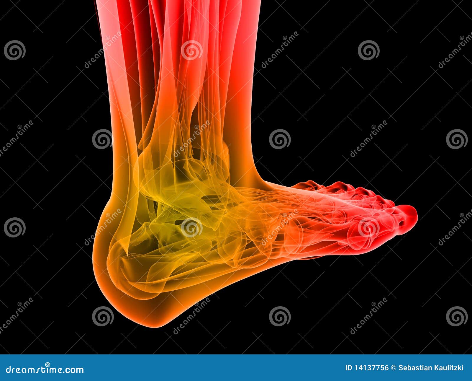 Painful foot stock illustration. Illustration of graphic - 14137756