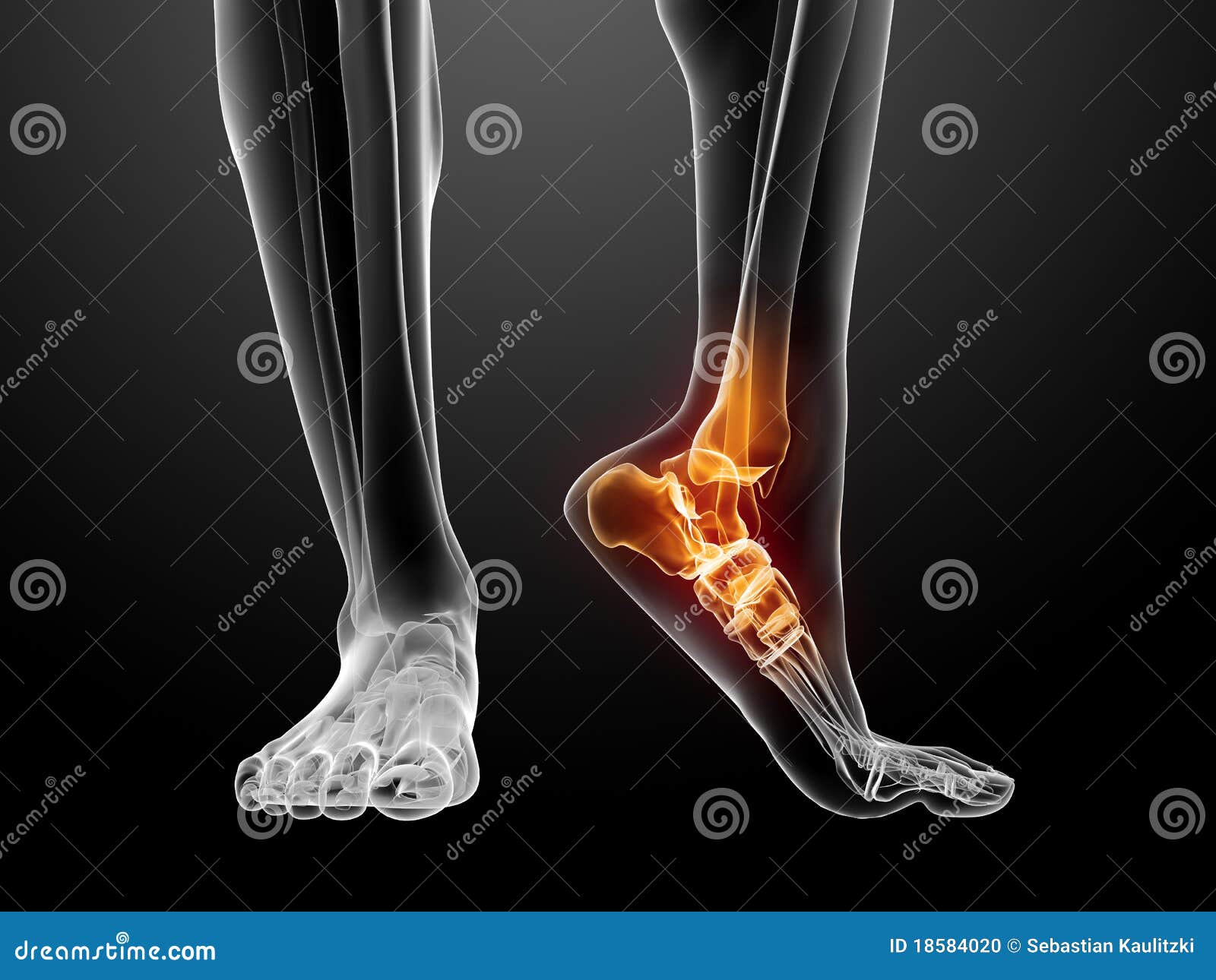 Painful foot illustration stock illustration. Illustration of ...