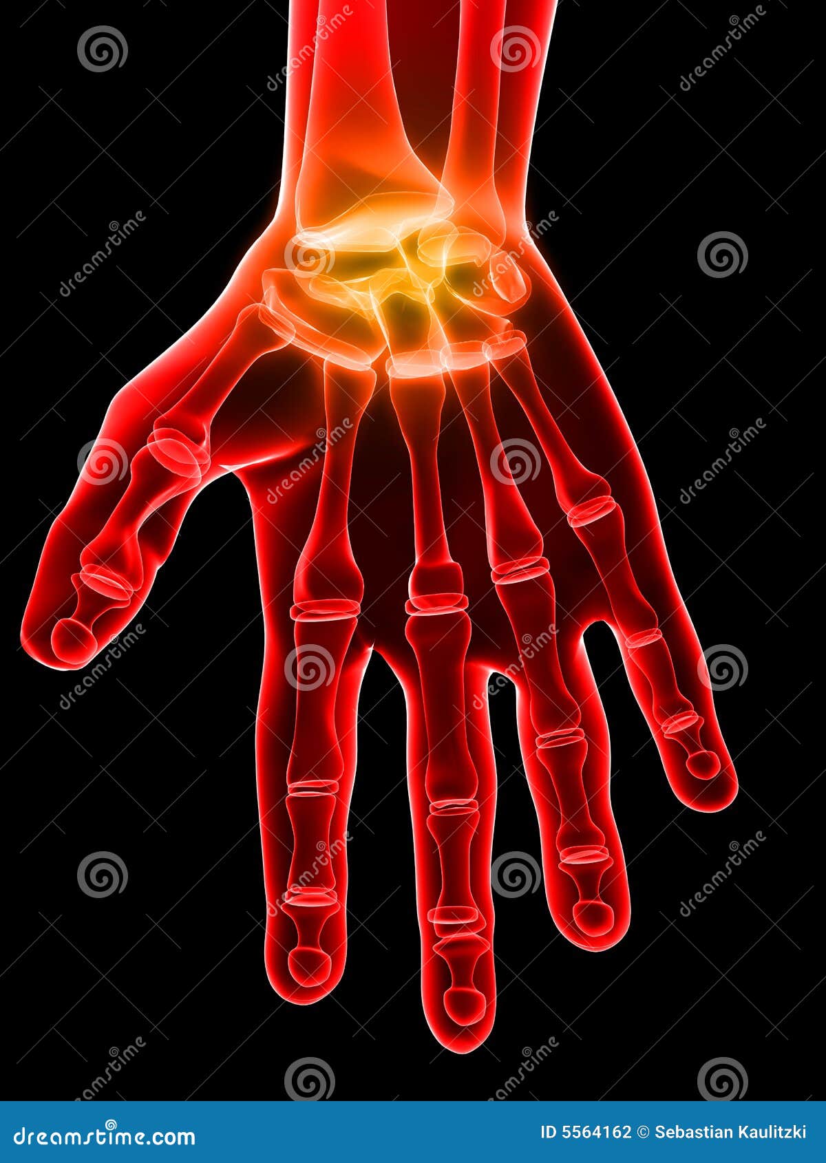 Painful Hand Joints Royalty-Free Illustration | CartoonDealer.com #9093996