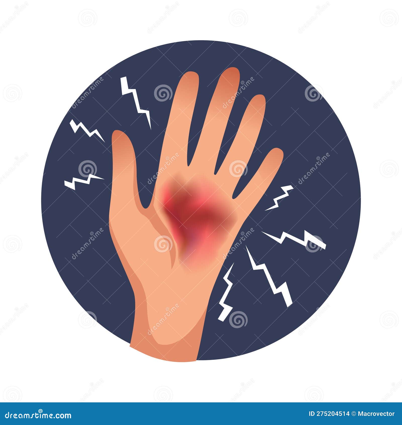 Hand Burn Icon stock vector. Illustration of hand, clipart - 275204514