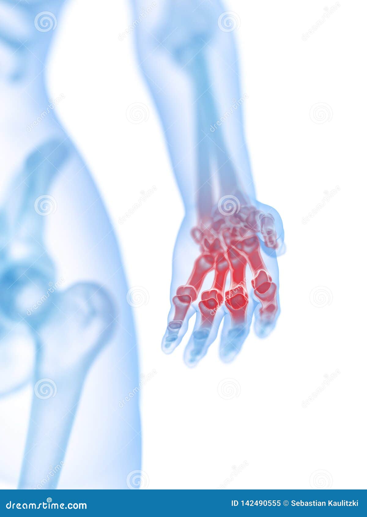 A painful hand stock illustration. Illustration of inside - 142490555