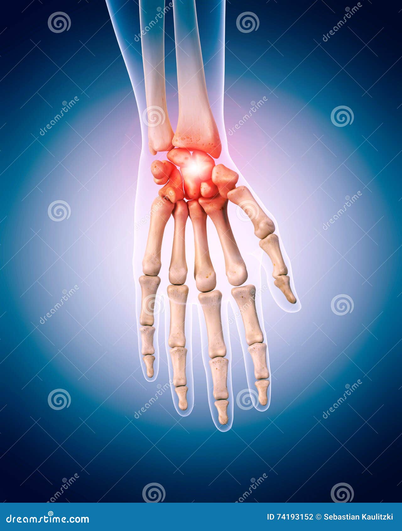 Painful Hand Stock Illustration | CartoonDealer.com #9166672