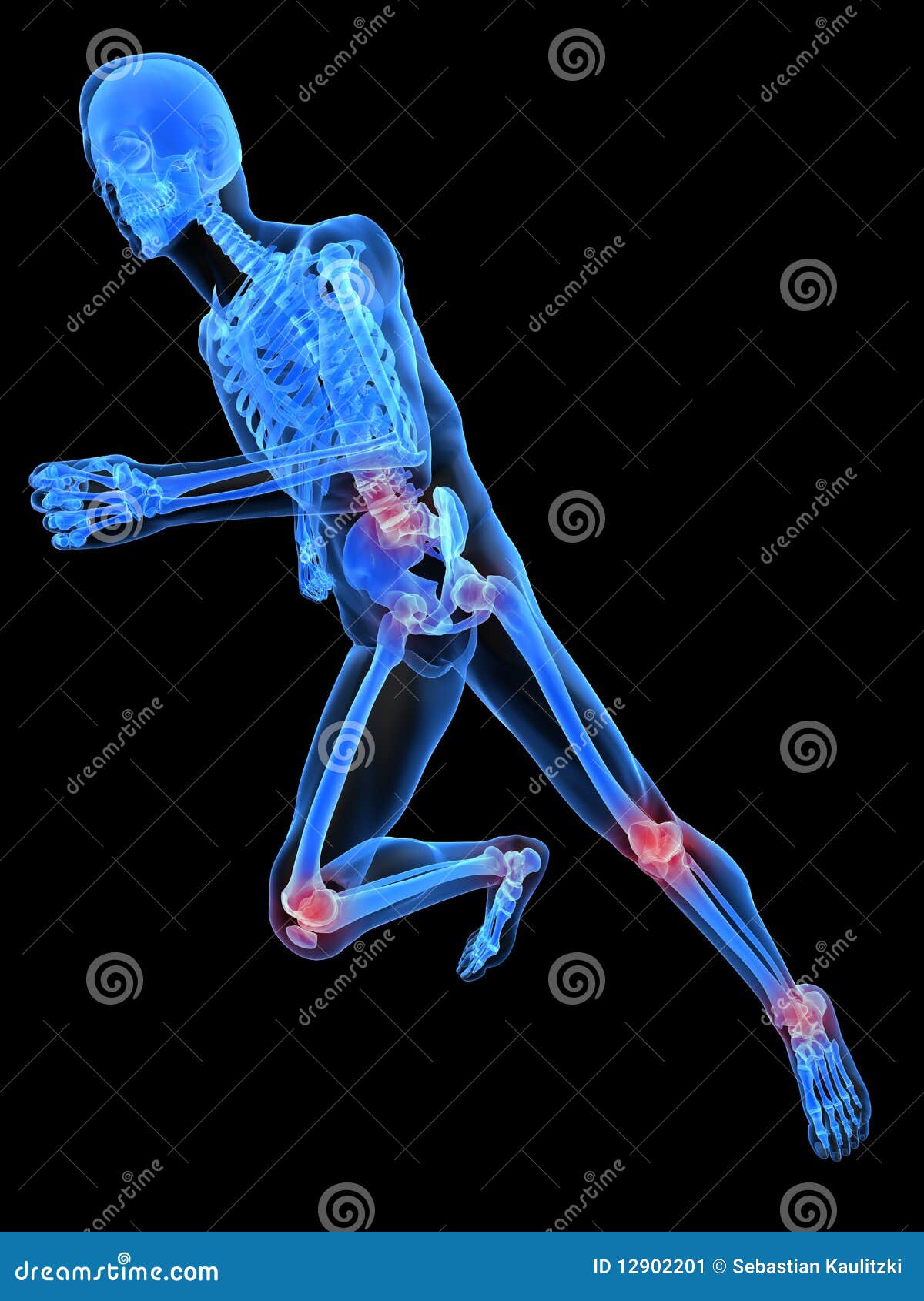 Painful joints stock illustration. Illustration of healthcare - 12902201