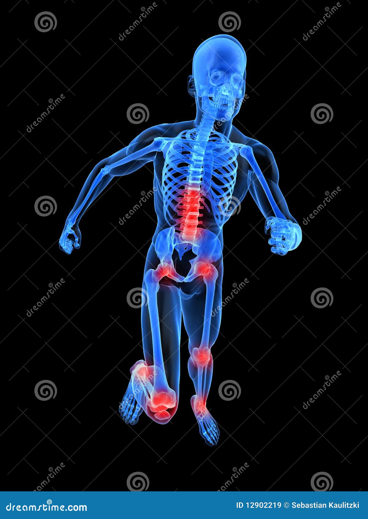 Painful joints stock illustration. Illustration of health - 12902219