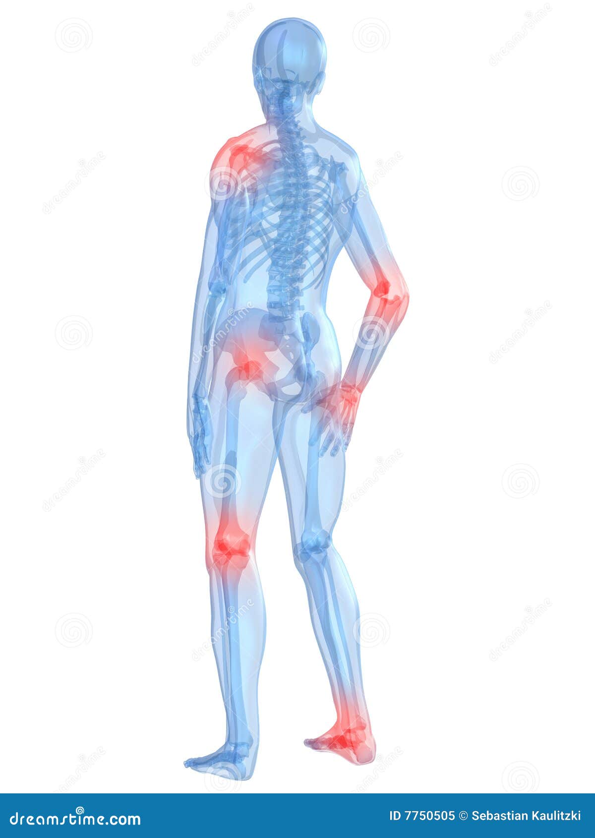 Painful joints stock illustration. Illustration of male - 7750505
