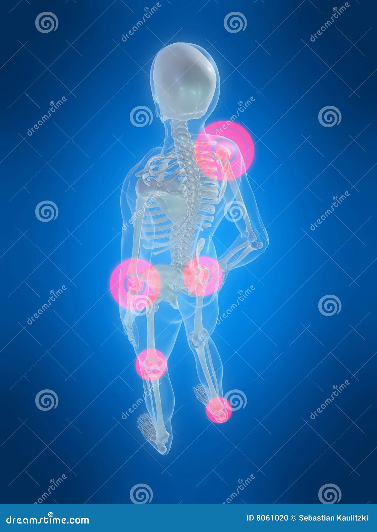 Painful joints stock illustration. Illustration of highlight - 8061020