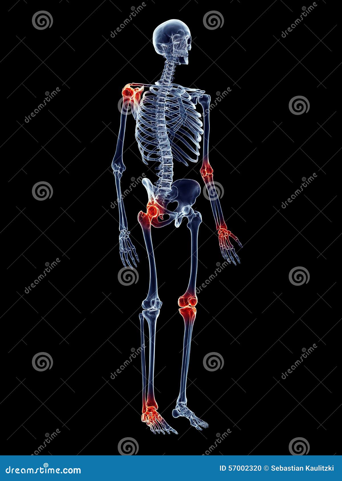 Painful joints stock illustration. Illustration of blue - 57002320