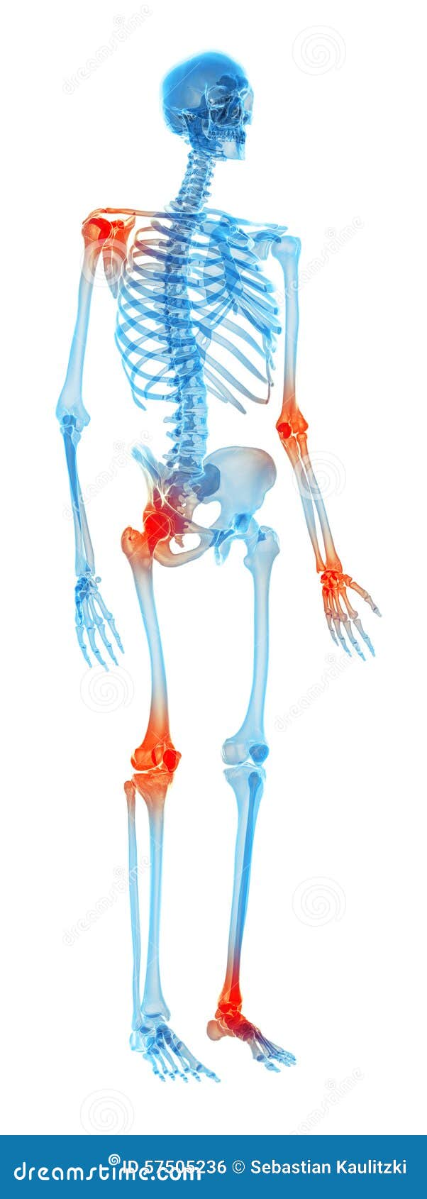 Painful joints stock illustration. Illustration of transparent - 57505236