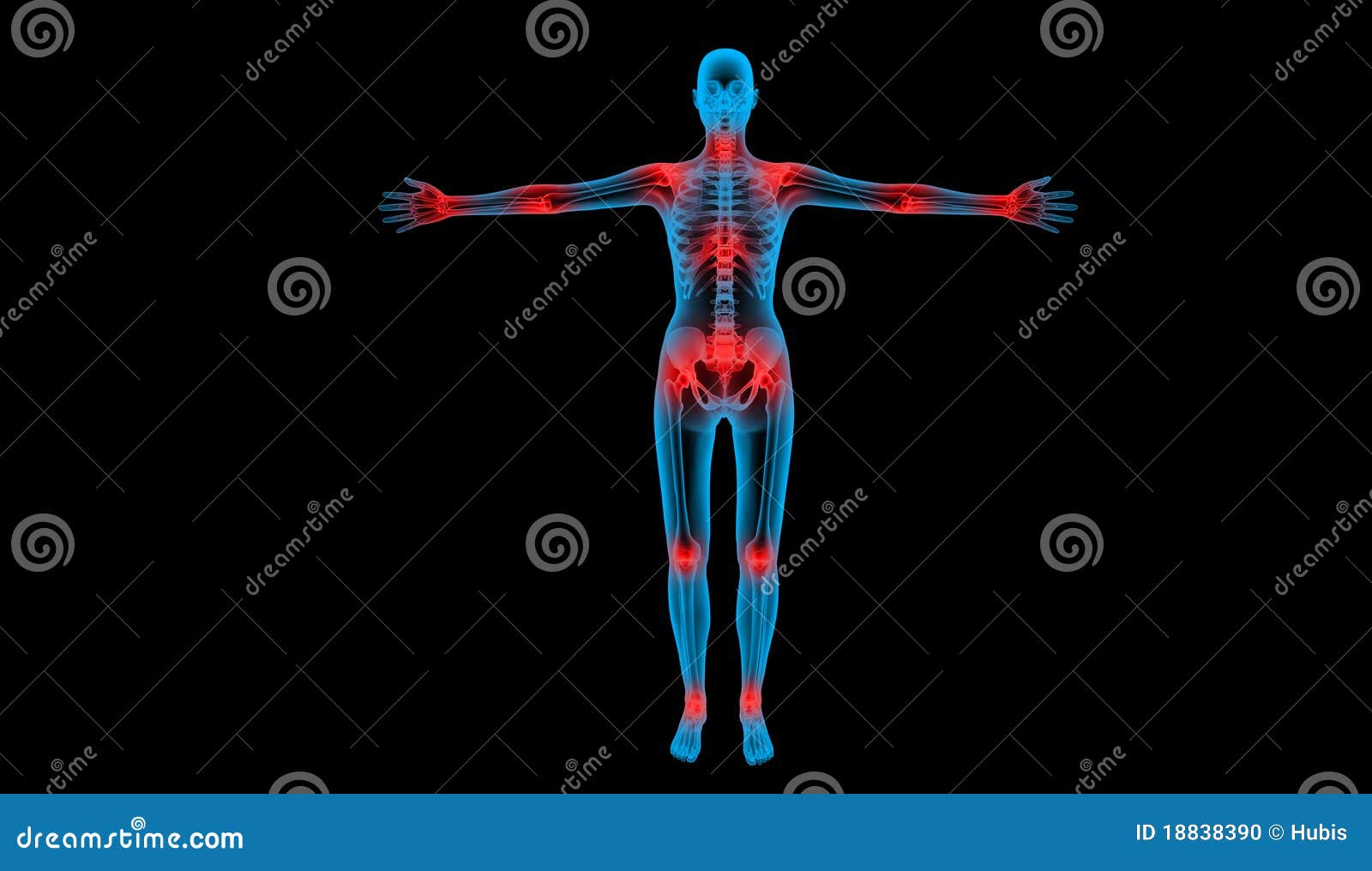 Painful joints x-ray body stock illustration. Illustration of backbone ...