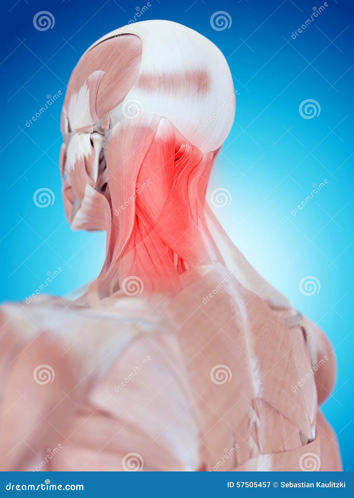 Painful Neck Concept Vector Illustration With Human Torso. Work ...