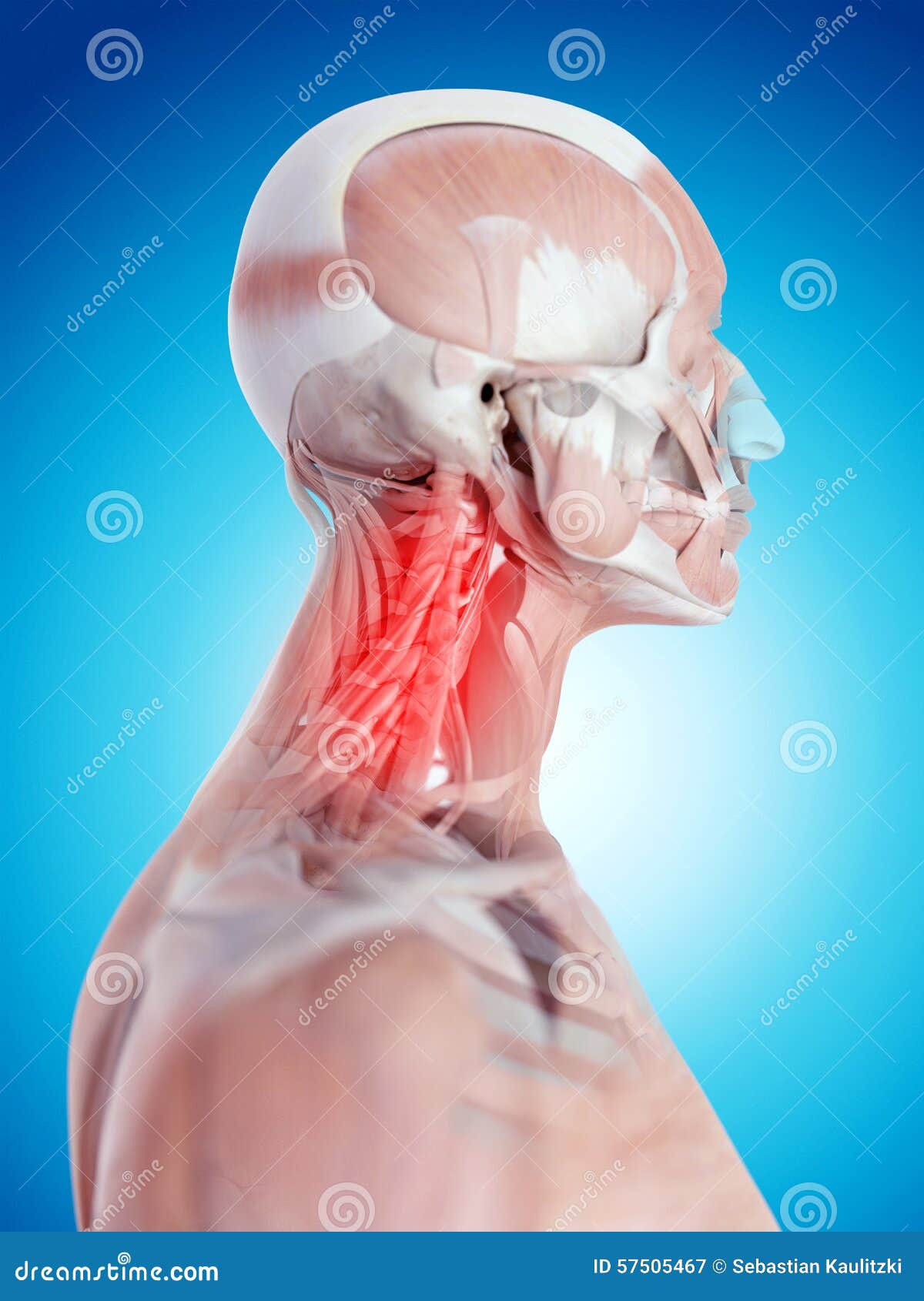 Painful neck stock illustration. Illustration of painful - 57505467