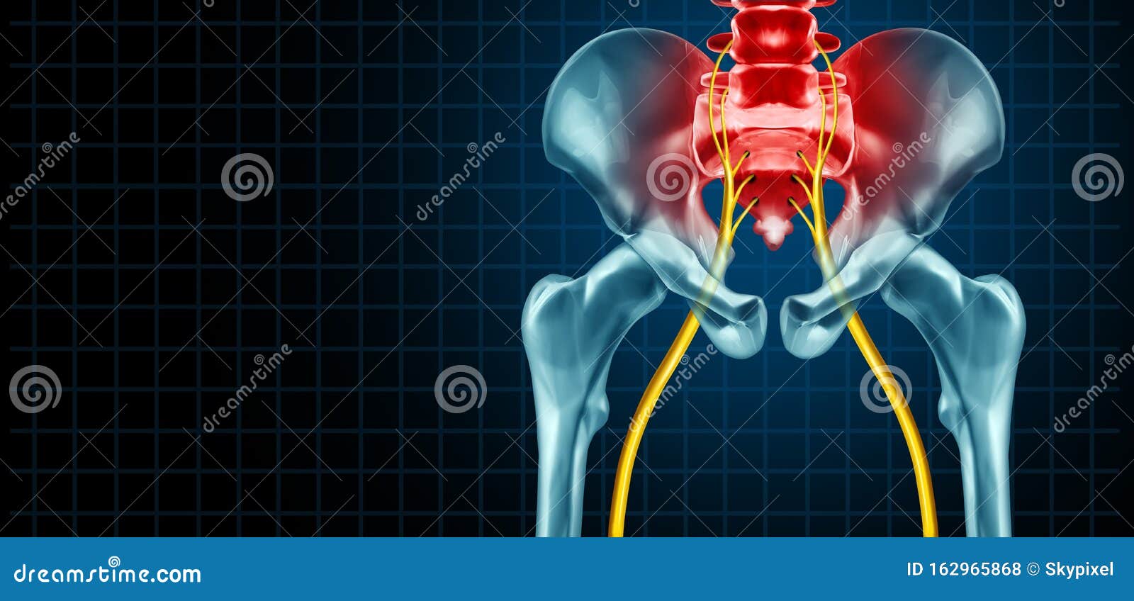 Sciatica As Symptom From Herniated Disc And Spinal Nerve Outline ... Sciatica As Symptom From Herniated Disc And Spinal Nerve Outline ...