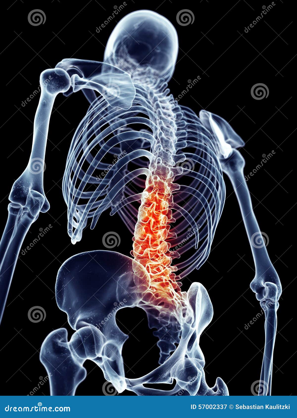 Painful spine stock illustration. Illustration of backache - 57002337