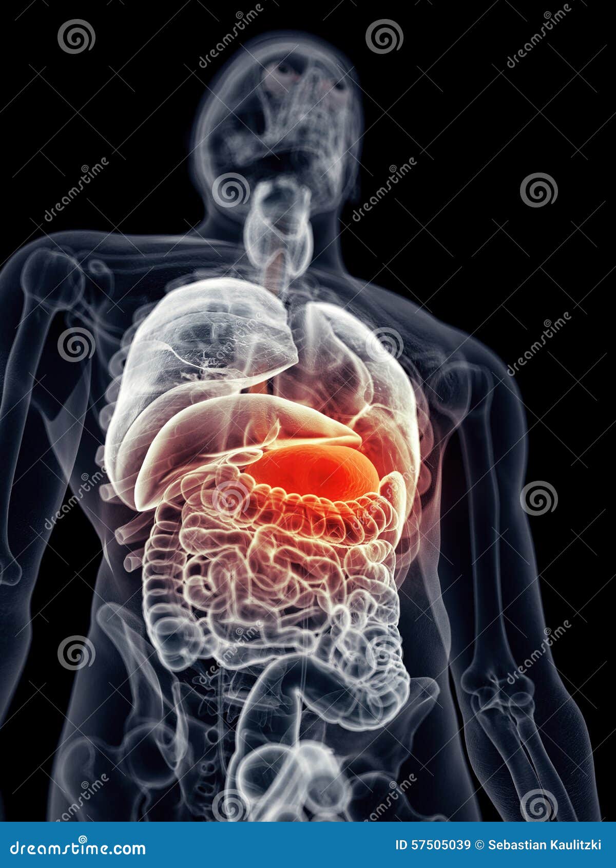 Painful Stomach, Gastritis, Helicobacter Pylori Bacteria Damaging Mucus ...