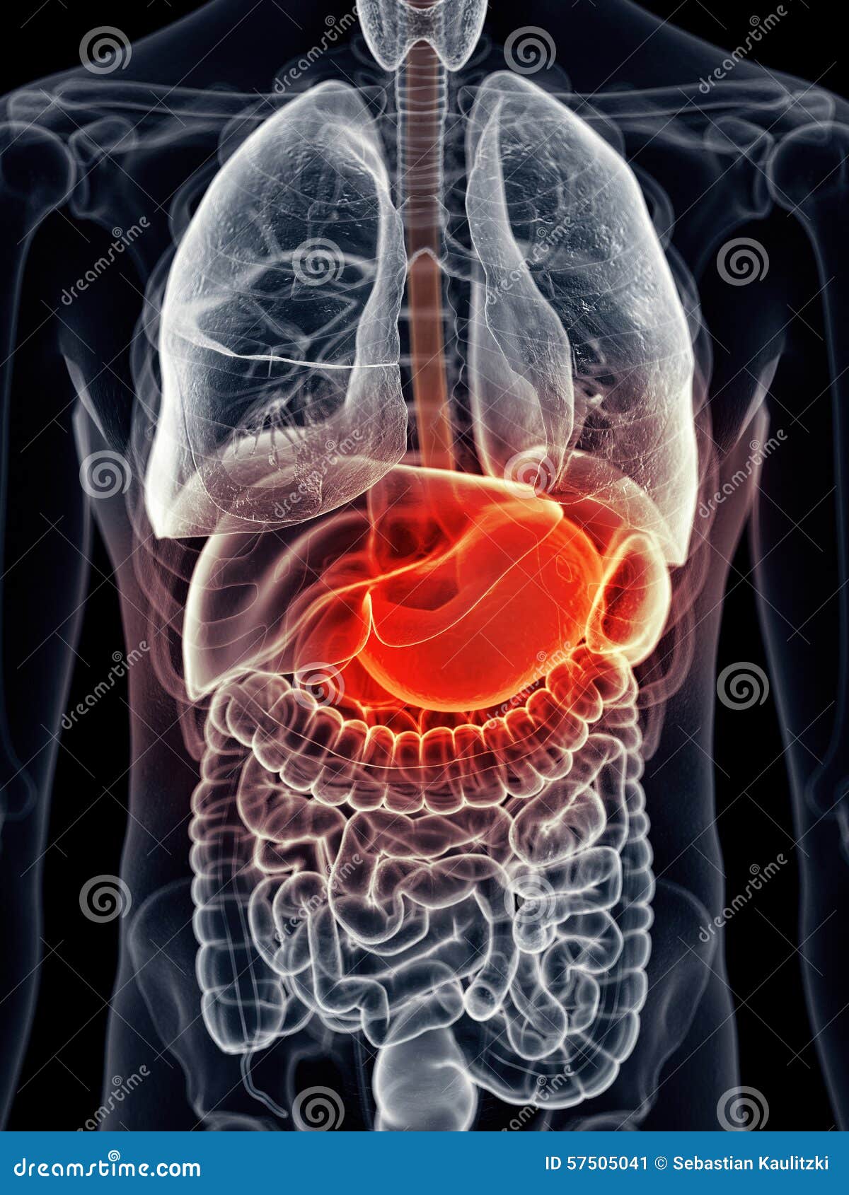 Painful Stomach, Gastritis, Helicobacter Pylori Bacteria Damaging Mucus ...