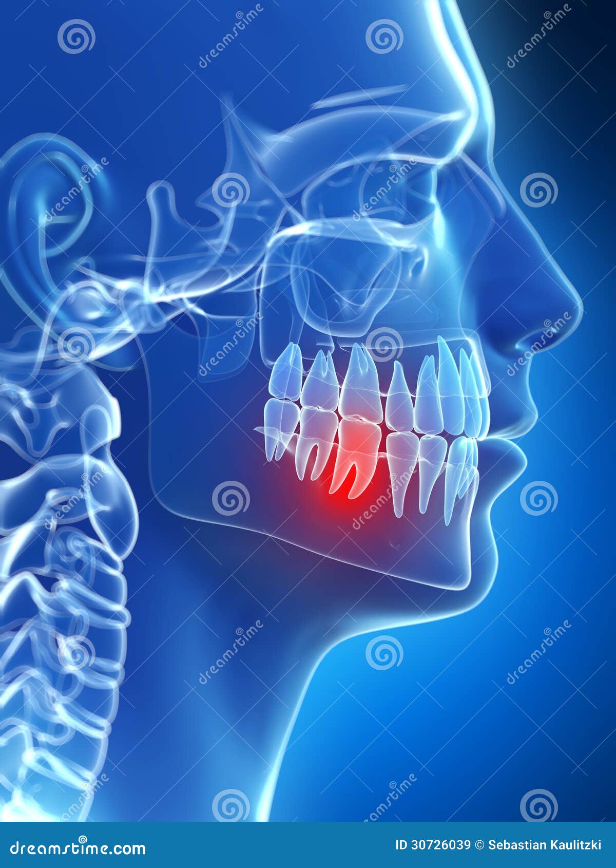 Painful tooth stock illustration. Illustration of human - 30726039