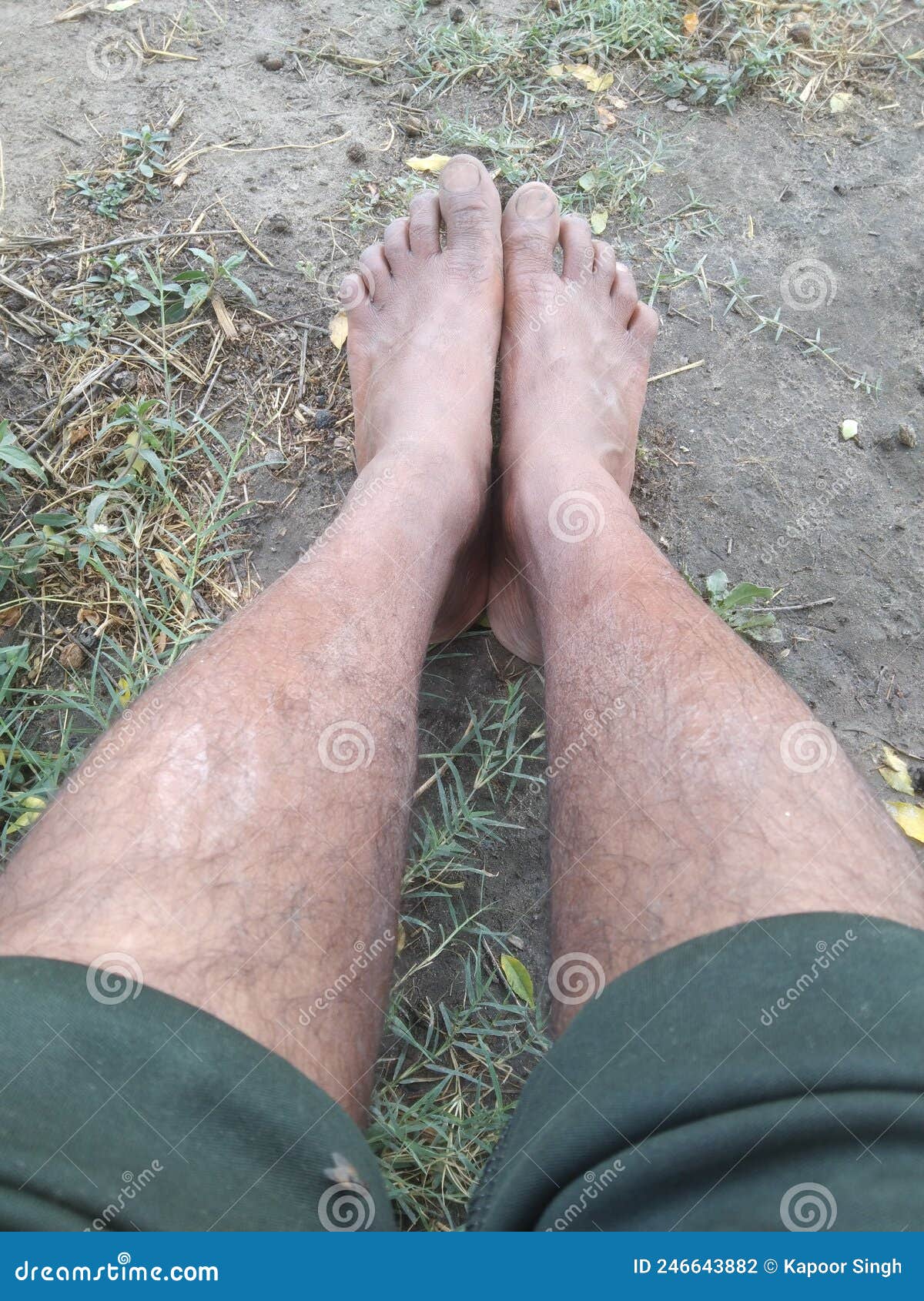The Pair of Dry and Dirty Legs Stock Photo - Image of dirtylegs, tree ...