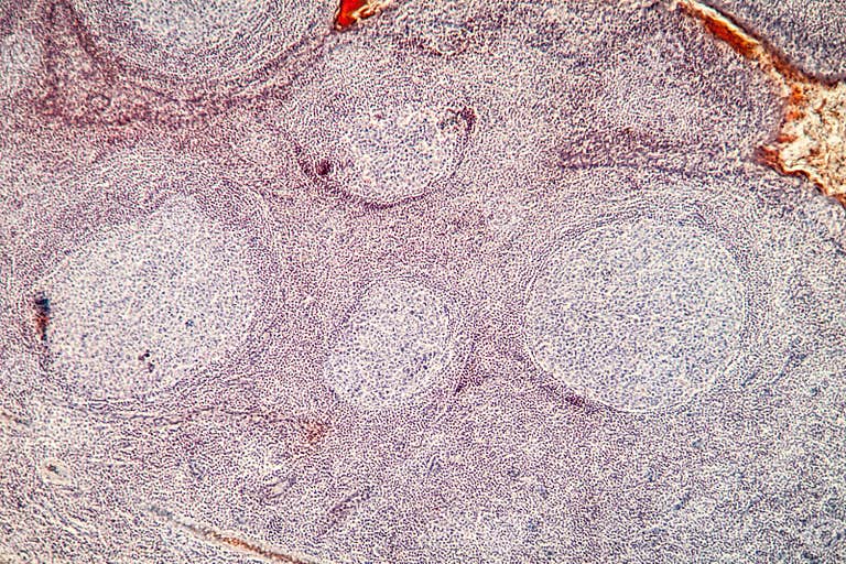 Palatal tonsils transverse stock photo. Image of system - 196730478