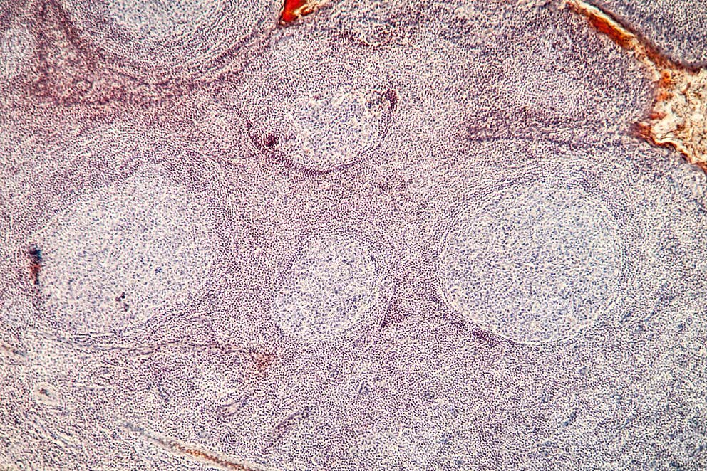 Palatal tonsils transverse stock photo. Image of system - 196730478