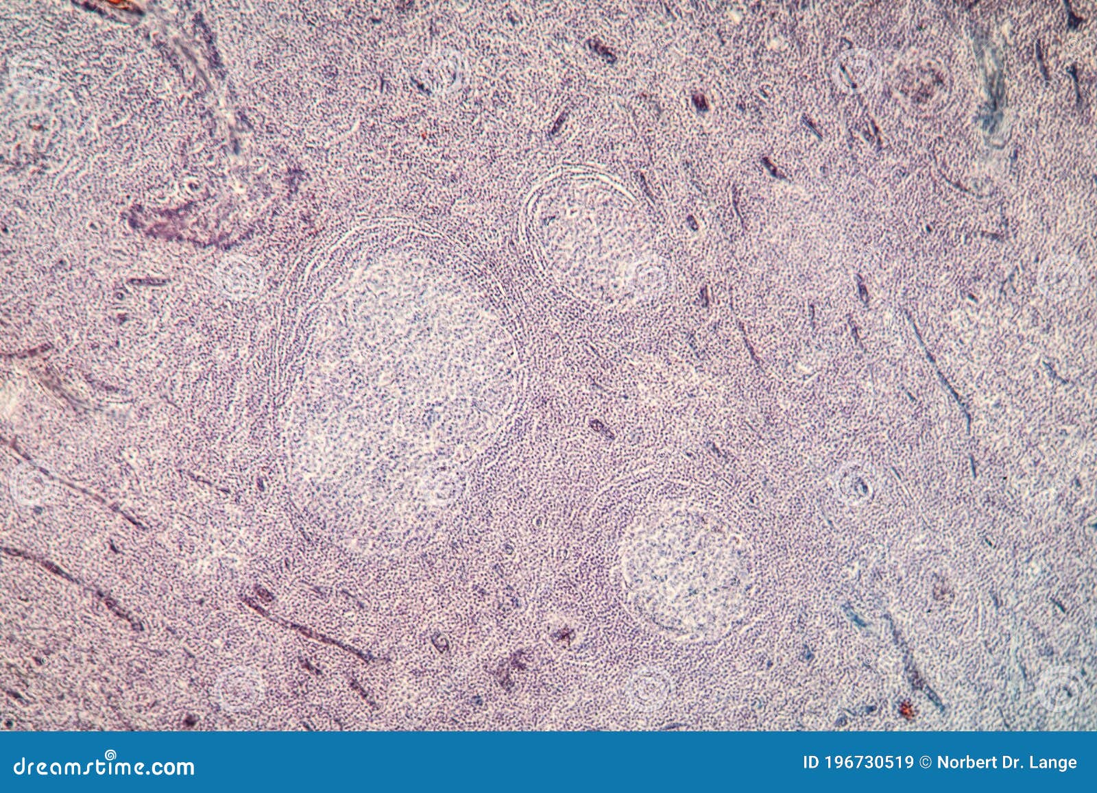 Palatal tonsils transverse stock image. Image of medicine - 196730519