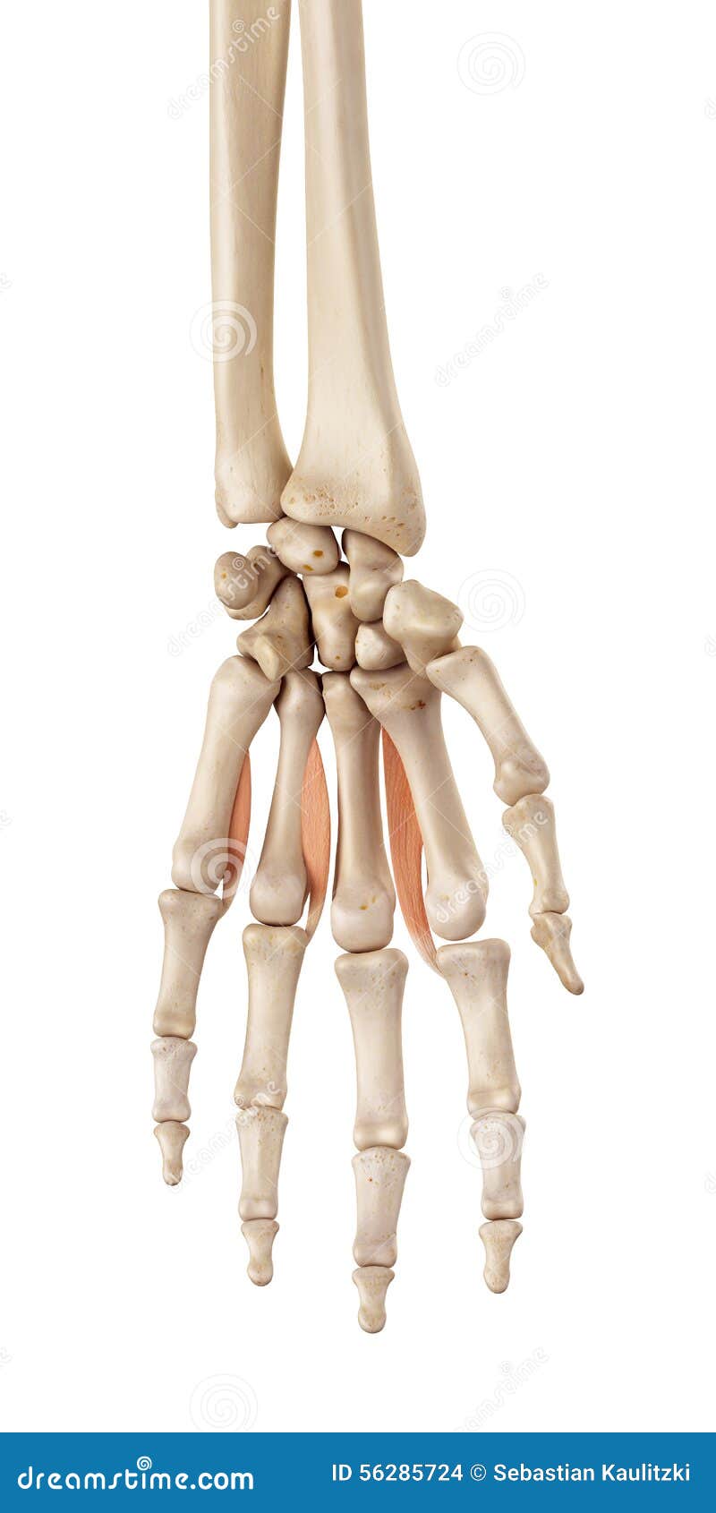X-ray Palmar Or Anterior View Of Right Human Hand Bones With Body ...