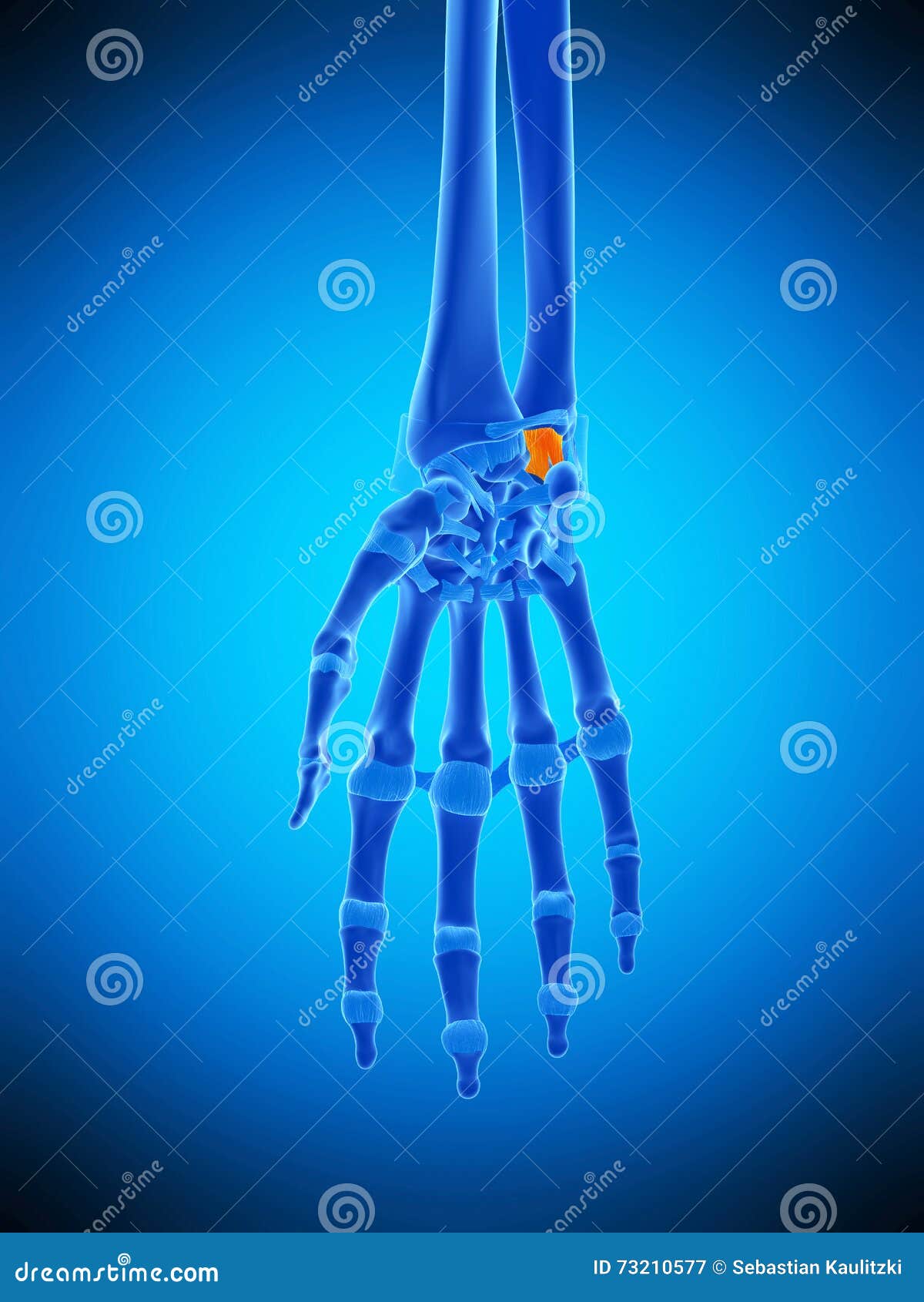 X-ray Palmar Or Anterior View Of Right Human Hand Bones With Body ...