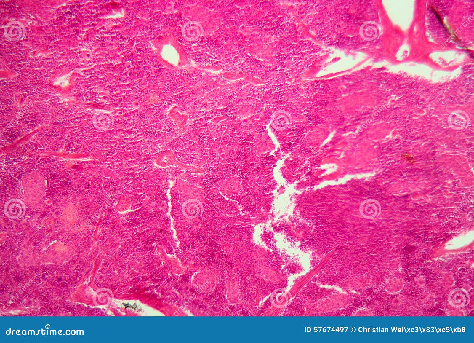 Pancreas Cells Under the Microscope Stock Image - Image of pathology ...