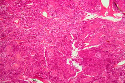 Pancreas Cells Under the Microscope Stock Image - Image of pathology ...