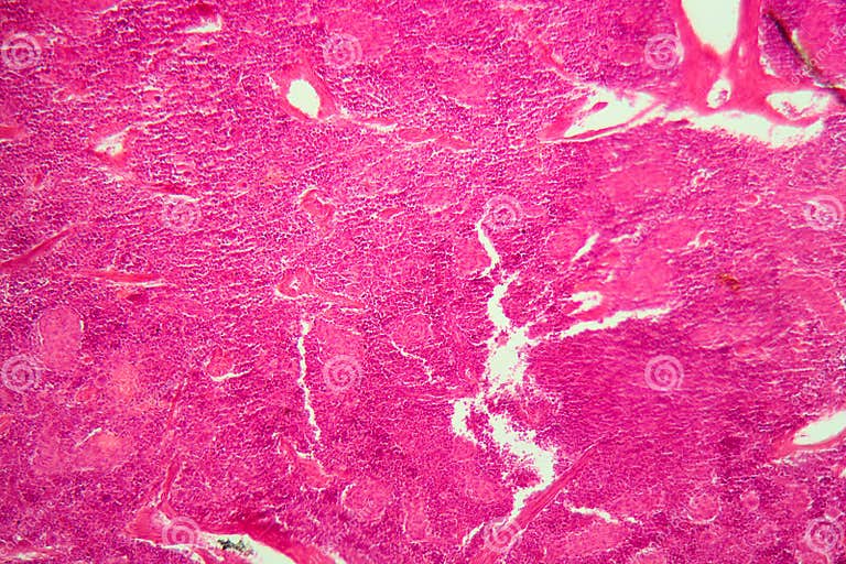 Pancreas Cells Under the Microscope Stock Image - Image of pathology ...