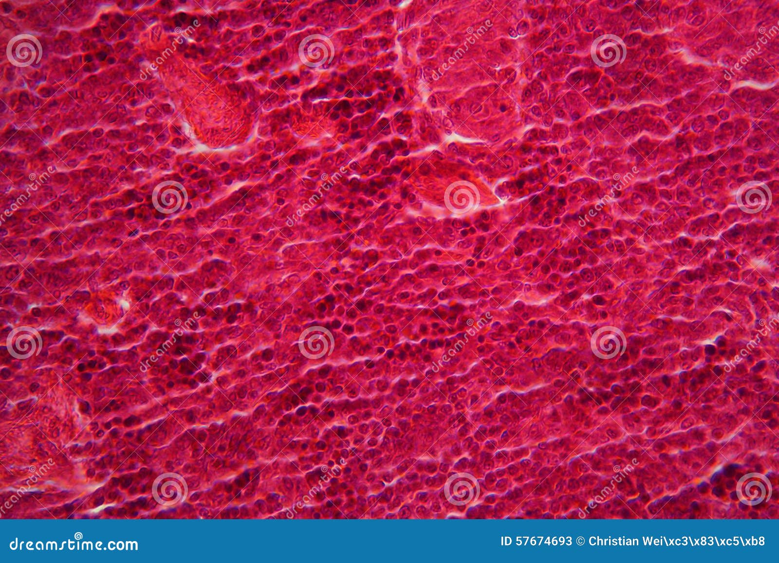 Pancreas Cells Under the Microscope Stock Image - Image of infection ...