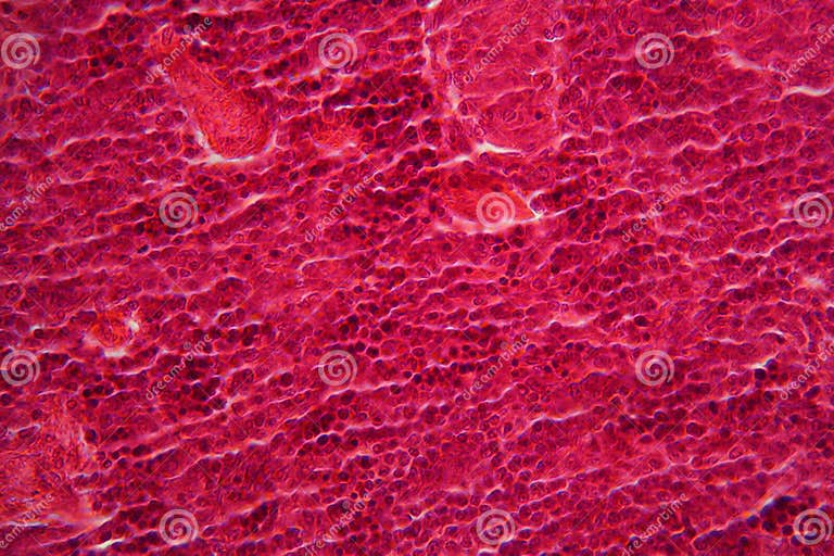 Pancreas Cells Under the Microscope Stock Image - Image of infection ...