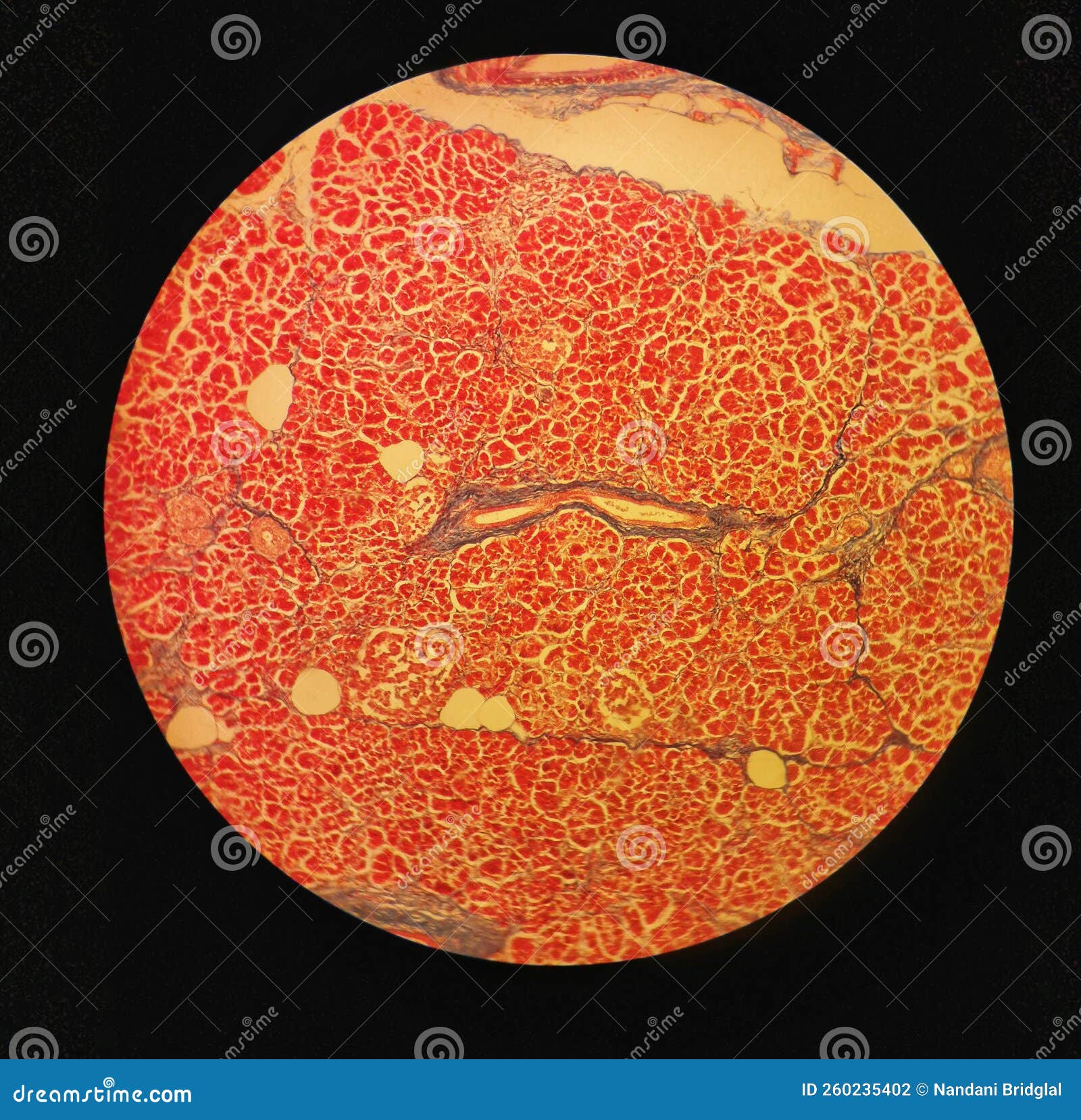 Pancreas Cross-Section stock photo. Image of organ, biological - 260235402