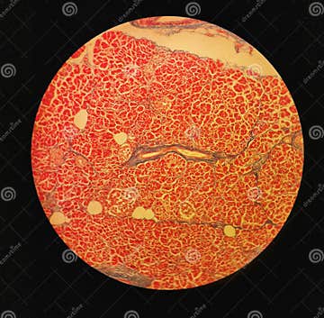 Pancreas Cross-Section stock photo. Image of organ, biological - 260235402