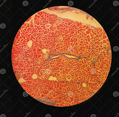 Pancreas Cross-Section stock photo. Image of organ, biological - 260235402