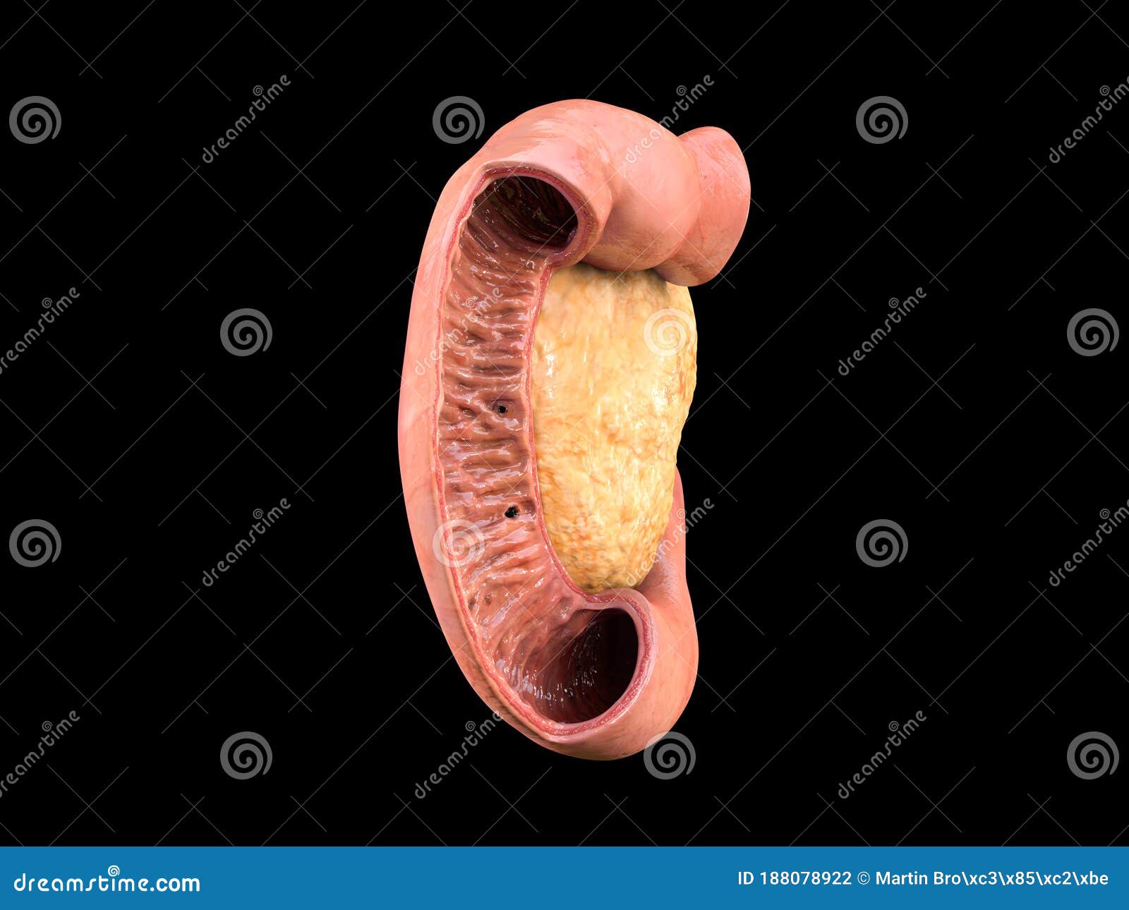 Pancreas, Human Anatomy, Posterior View, Duodenum, On White Background ...