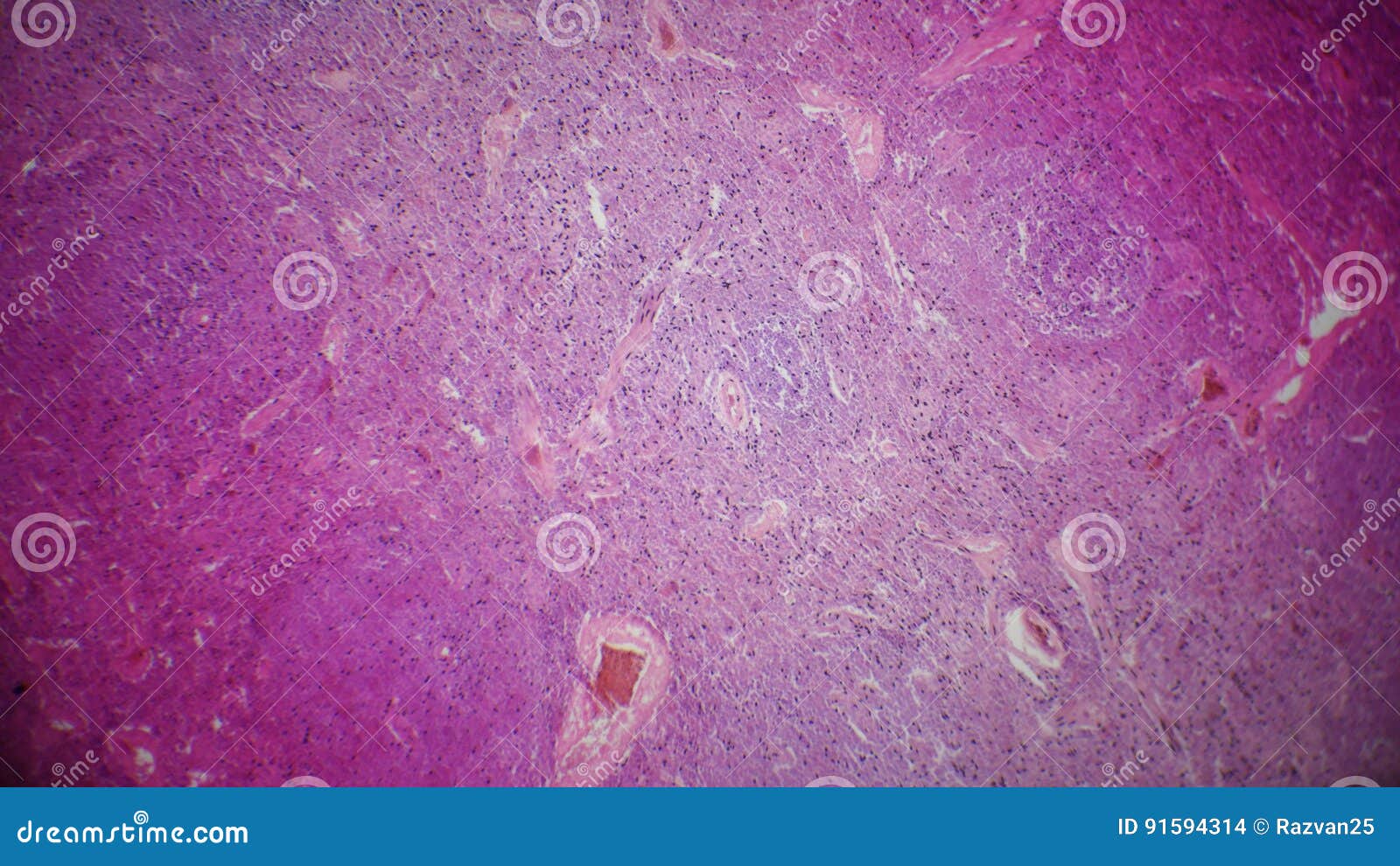 Pancreas Section Under The Microscope Stock Photo | CartoonDealer.com ...