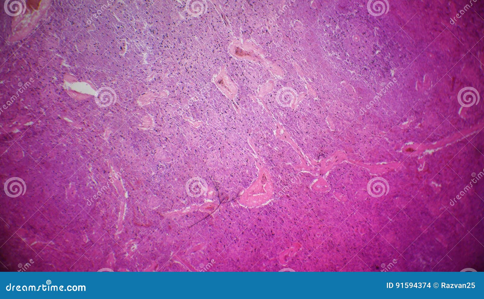 Pancreas Section Under the Microscope Stock Photo - Image of biology ...