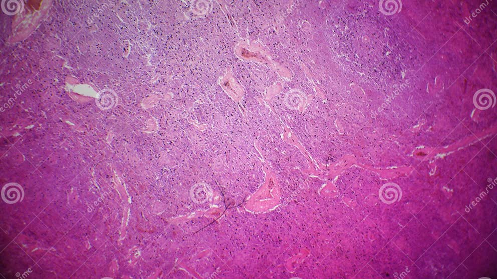 Pancreas Section Under the Microscope Stock Photo - Image of biology ...