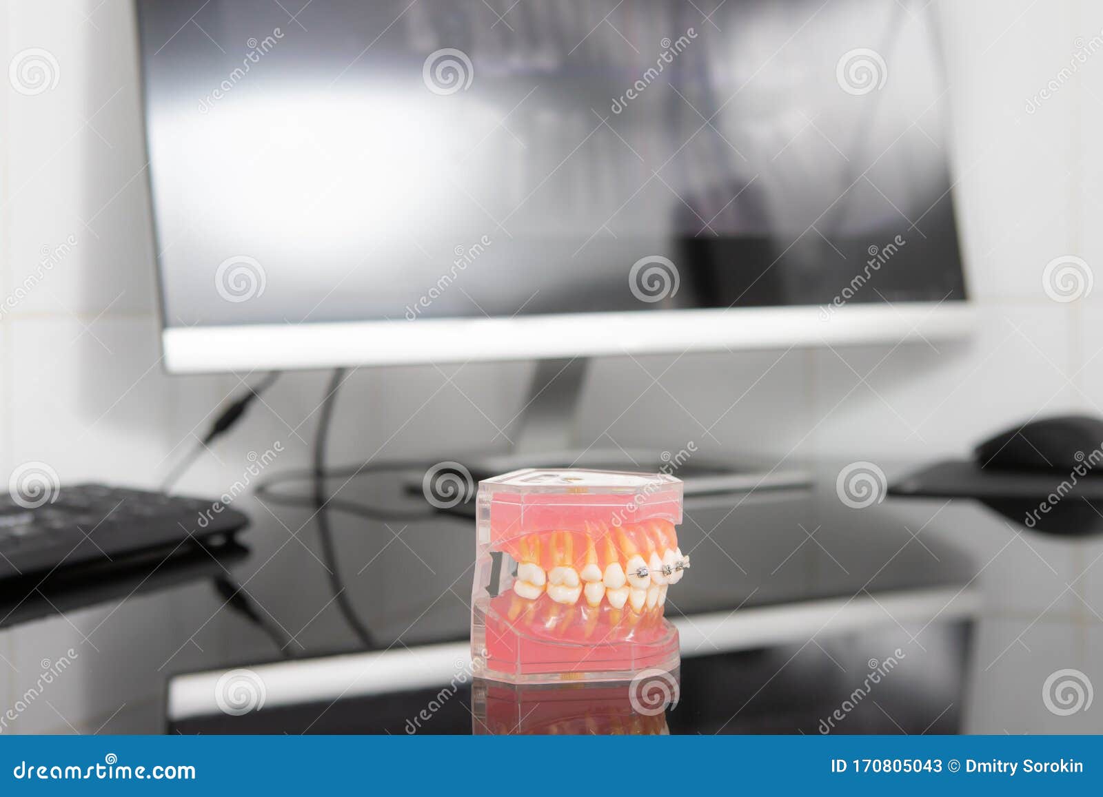 Panoramic X-ray on Computer Screen. Model of the Jaw on the Table Stock ...