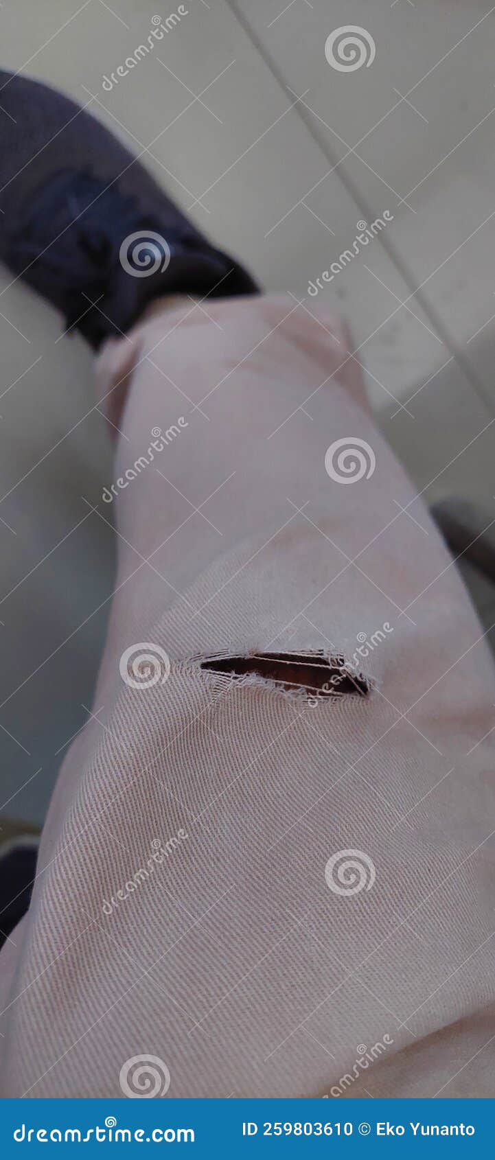 The Pants are Torn Due To Being Scratched by a Wire or Sharp Object ...