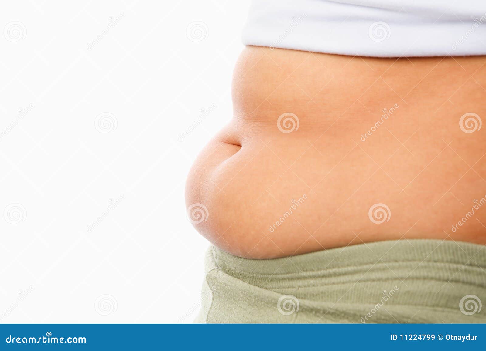 Panza Gorda Para El Concepto Obeso Imagen de archivo - Imagen de ...