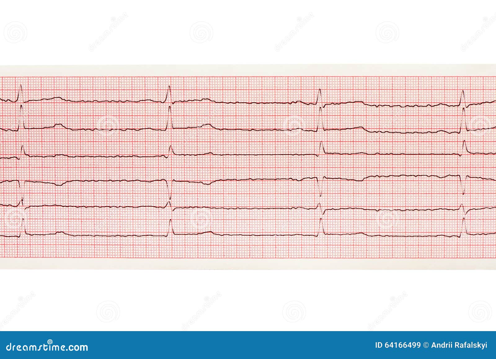 Paper ECG Results Isolated on White Stock Image - Image of laboratory ...