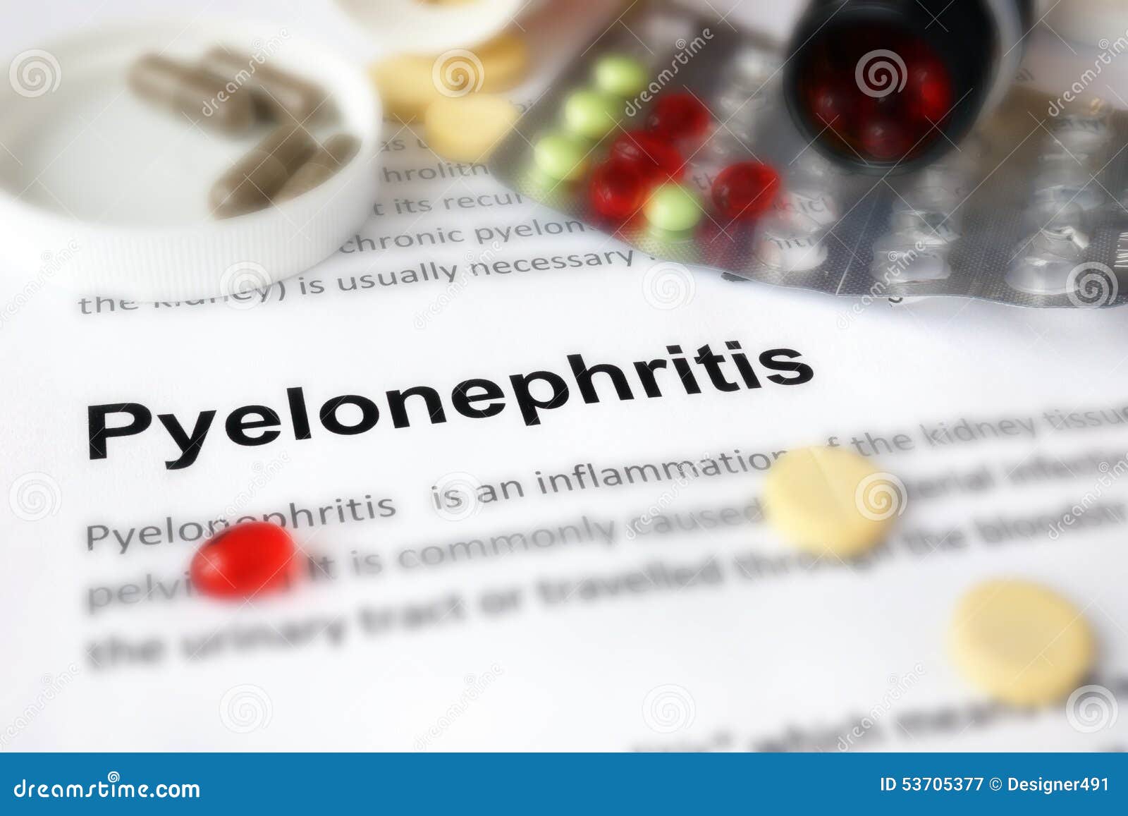 337 Pyelonephritis Treatment Stock Photos - Free & Royalty-Free Stock ...