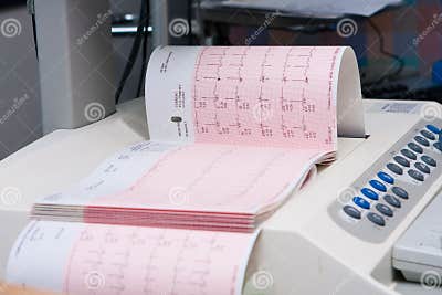 Paper Read-out of Treadmill Test Stock Photo - Image of leads ...