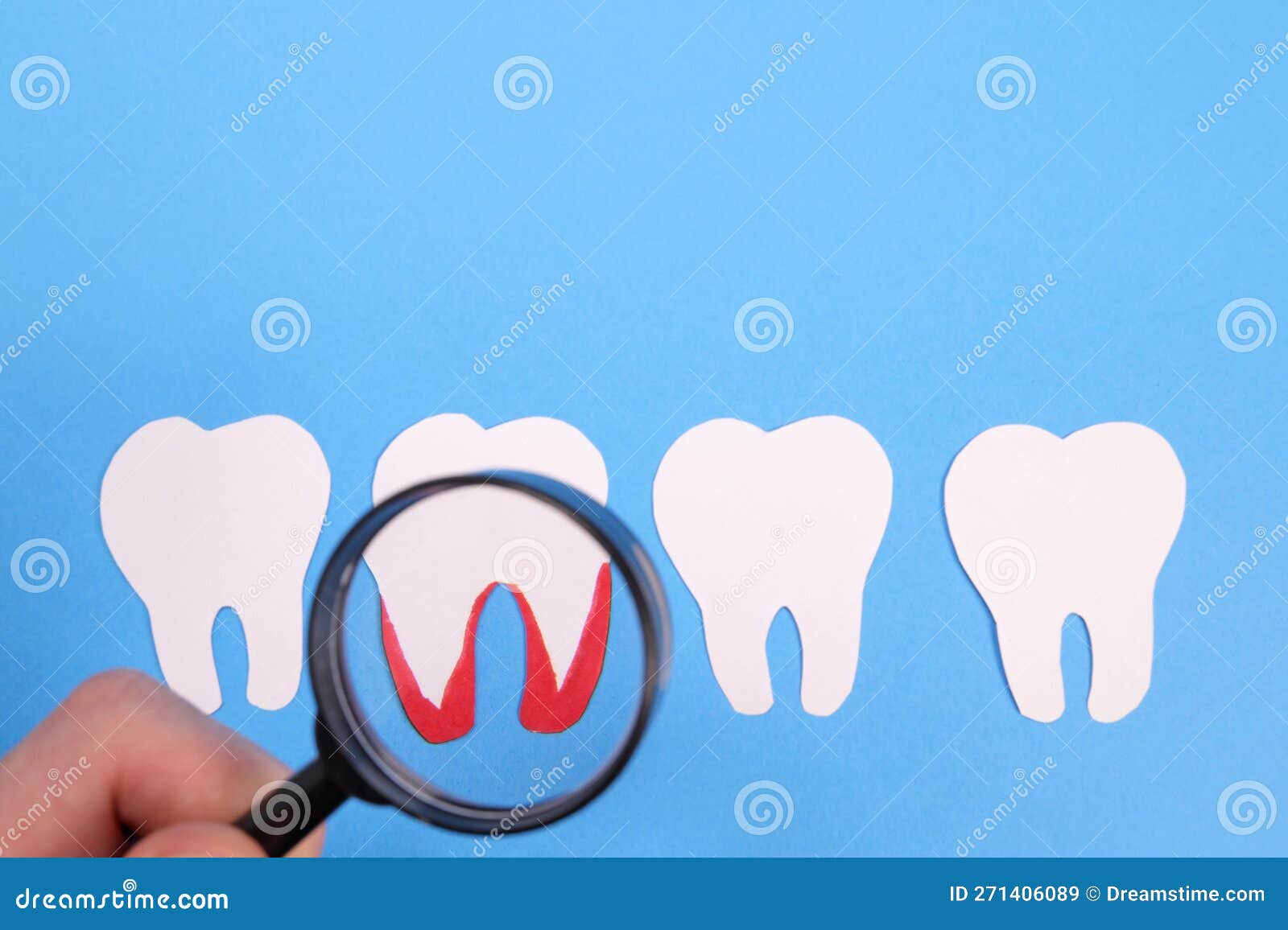 Paper Teeth with Root Inflammation, Dental Care Concept, Dental ...