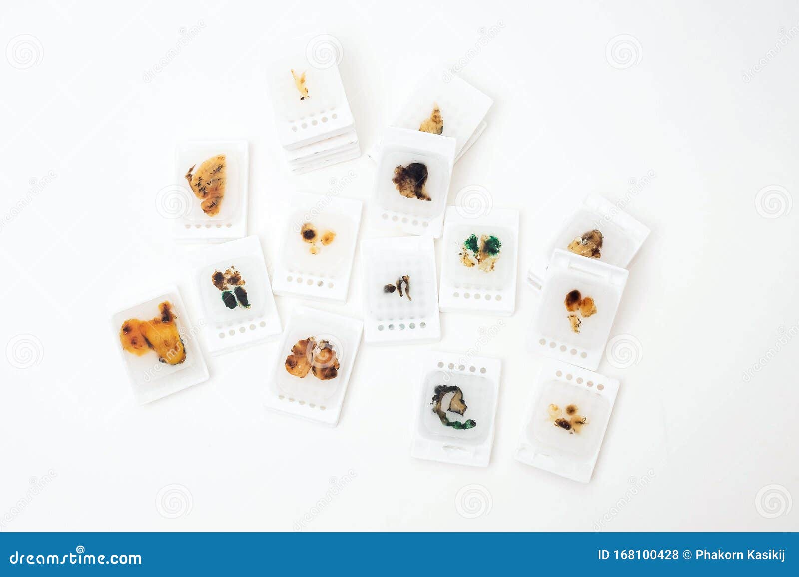 Paraffin Embedded Tissue Blocks of Cancer on ISolated White Background ...