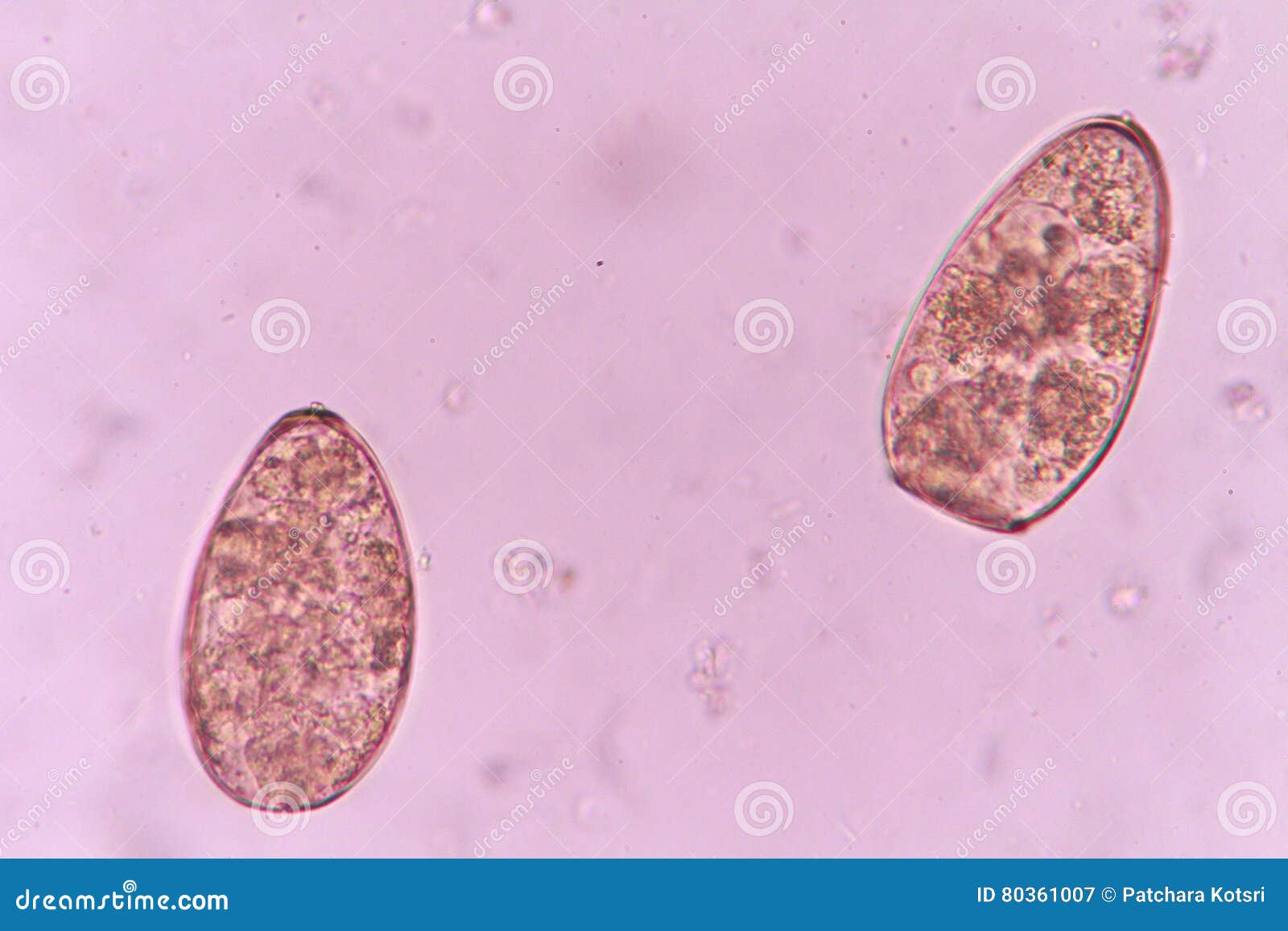 Paragonimus stock image. Image of disease, medical, tissue - 80361007